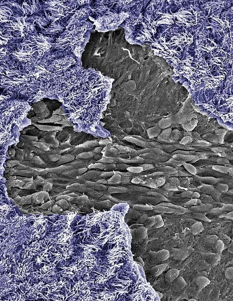 Hirnforschung: Hirnwasser transportiert neue Nervenzellen - Spektrum ...