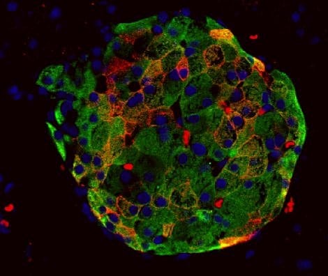 Medizin: Selbstversorger - Spektrum der Wissenschaft