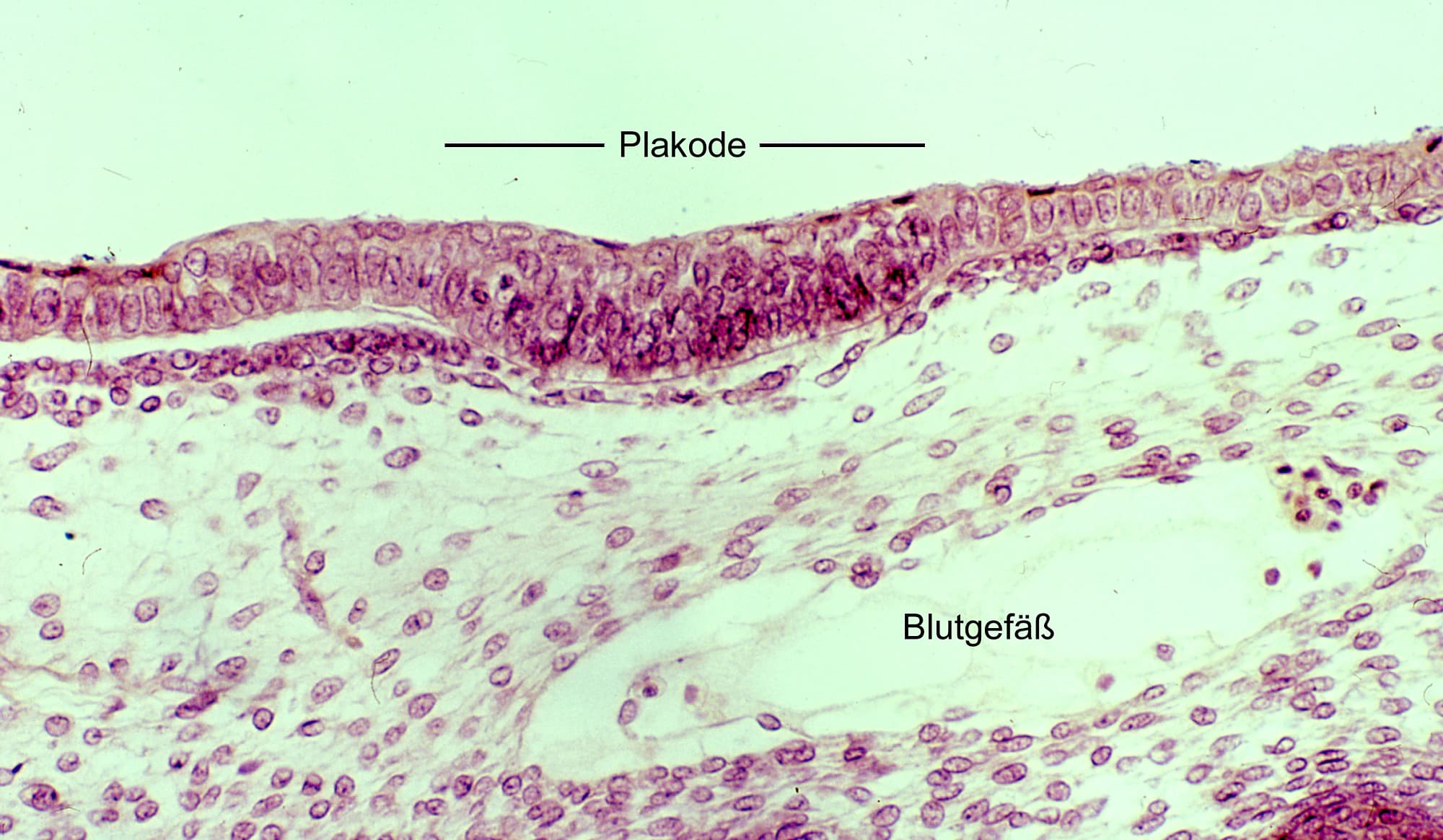 Von Plakoden und anderen Ungeheuerlichkeiten - Spektrum der Wissenschaft