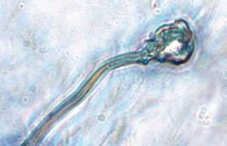 Stammzellforschung: Erstmals menschliche Spermien im Labor gezüchtet ...