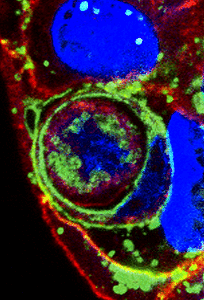 Zelltod: Hinter feindlichen Linien - Spektrum der Wissenschaft
