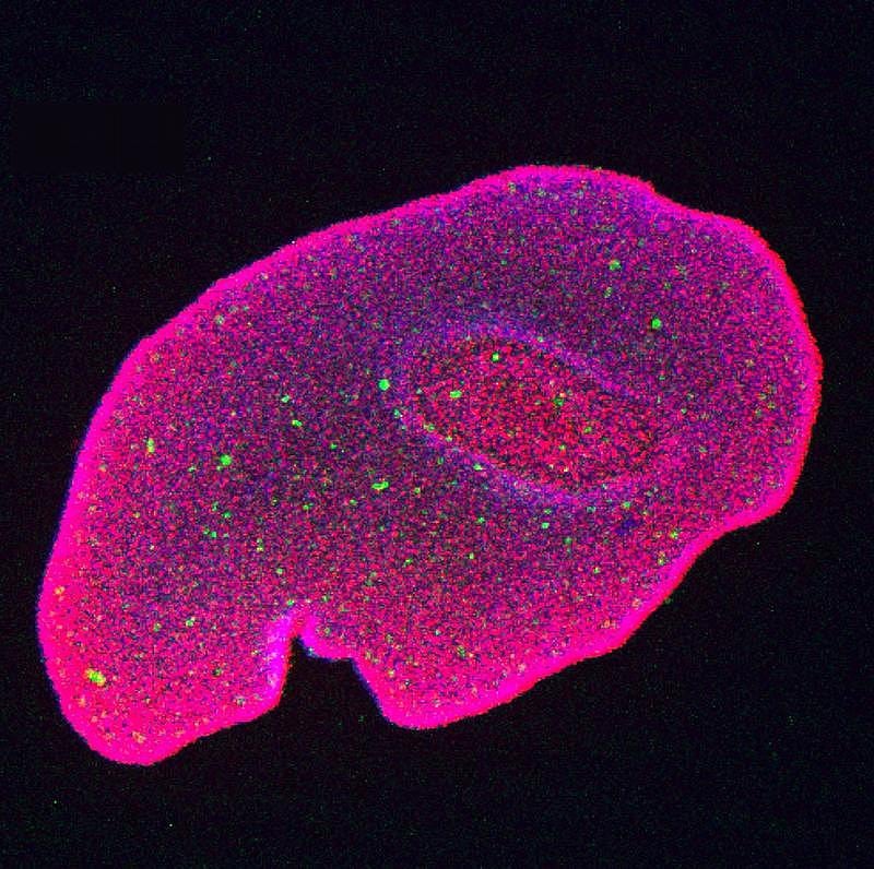 Genetik: Genom des primitivsten Vielzellers entziffert - Spektrum der ...
