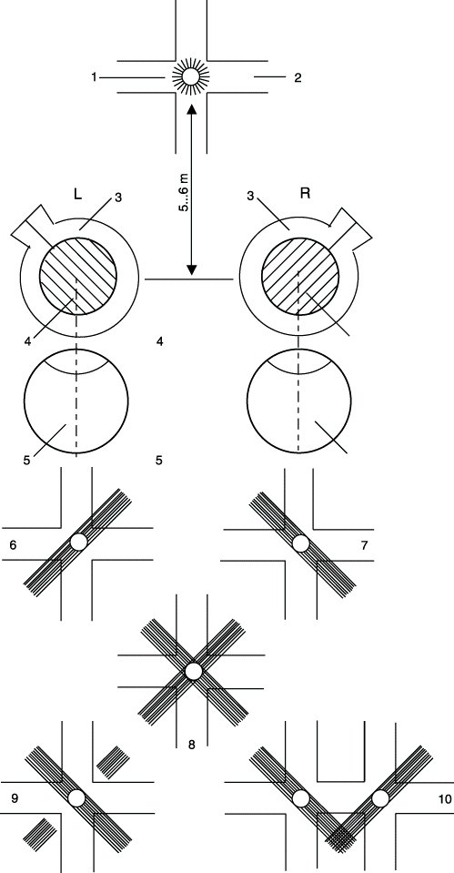 Bagolini-Test - Lexikon der Optik